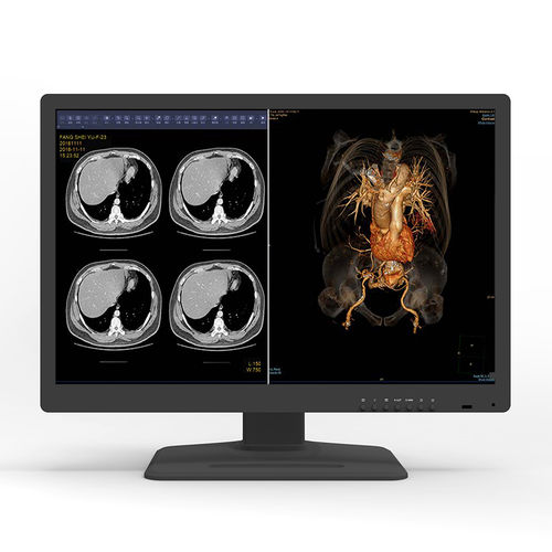 Diagnostic display - 30X6C-I1 - KTC Medical Solutions - radiology / 30 ...