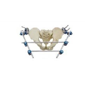 Pelvis external fixation system - T8012 - Orthopromed - tubular / adult