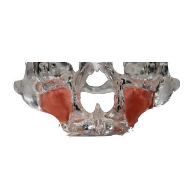 Maxilla anatomical model - 3D-111-T - Selmodels SL - transparent
