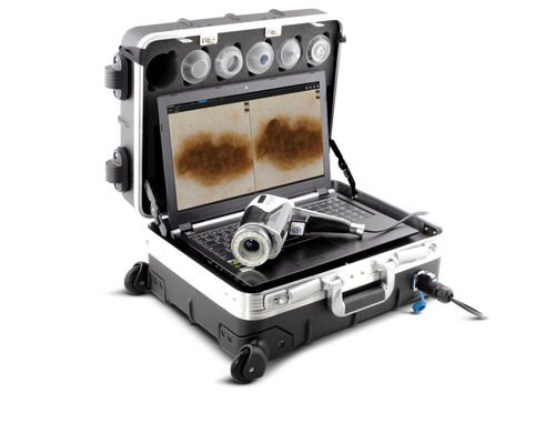Video dermatoscope - VIDIX - CANFIELD SCIENTIFIC SRL - white LED ...