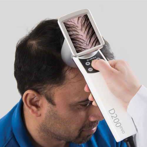 Video trichoscope - HairMetrix® - CANFIELD - computer-based