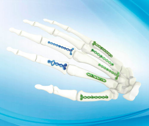 Hand phalange compression plate - WEGO Medical - metacarpal joint / locking