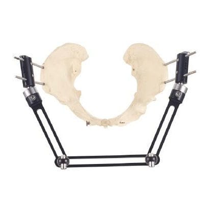 Pelvis external fixation system - Wuhan Yijiabao Biological Materials ...