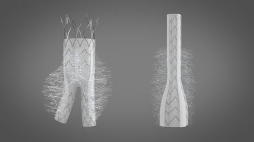 Abdominal aorta vascular prosthesis - KARDIOZIS - Affluent Medical ...