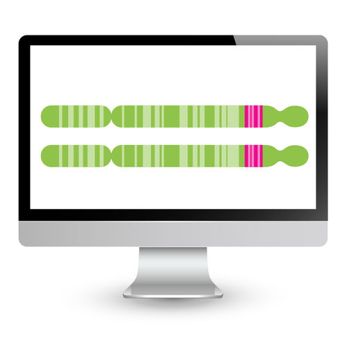 FHSD diagnostic molecular biology analyzer - EnFocus™ - Bionano Genomics