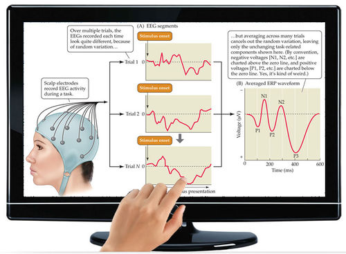 Analysis software - EPROBE - ScienceBeam - medical / EEG