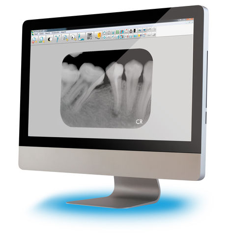 Dental imaging software - Apixia - viewer / treatment / dental