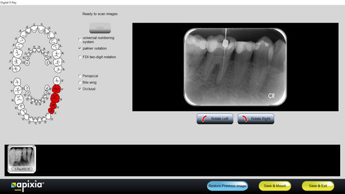 Dental imaging software - Apixia - viewer / treatment / dental