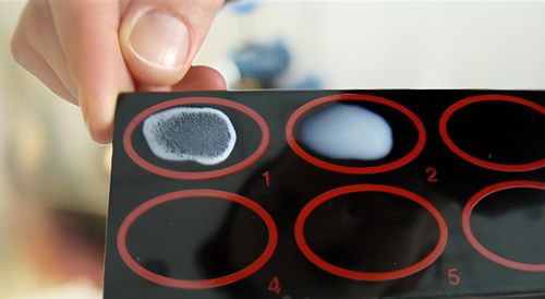 Coagulation test kit - 3321 - MEDIPAN GmbH - D-dimer / fibrin / FDP