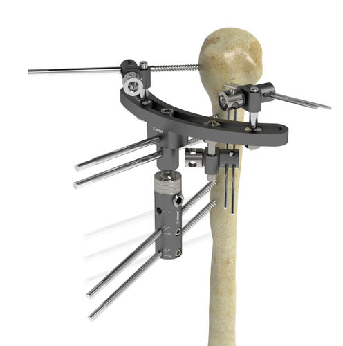 Humerus external fixation system - 5294-0000 - Zimed Medical - hybrid ...