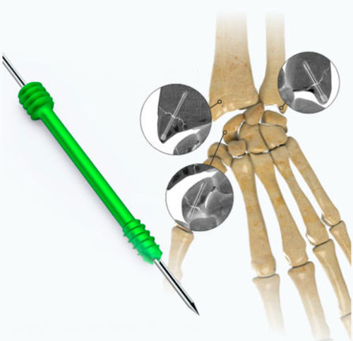 Hand compression bone screw - Zimed Medical - cannulated