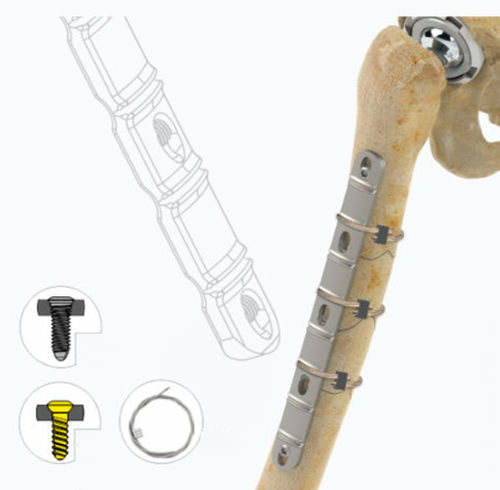 Large bone fragment compression plate - 1982 Series - Zimed Medical
