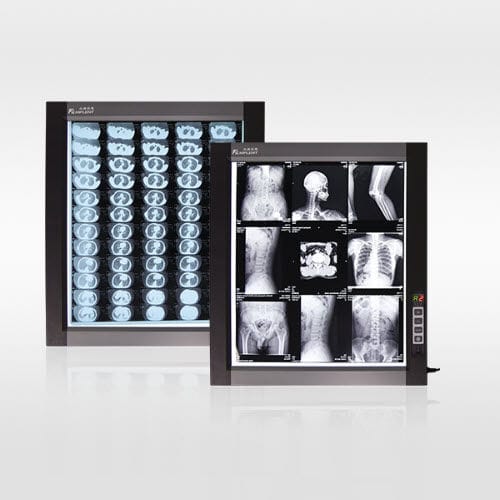 Digital X-ray film viewer - ZG-1D - Hunan Mplent Optoelectronics ...