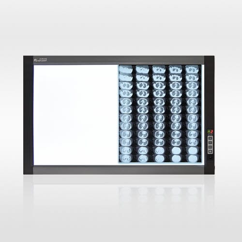 Digital X-ray film viewer - ZG-2D - Hunan Mplent Optoelectronics ...