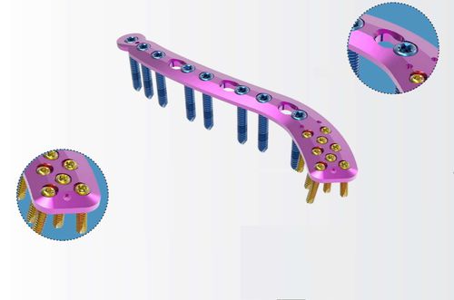 Clavicle compression plate - TRUE LOCK Superior Distal Clavicle ...