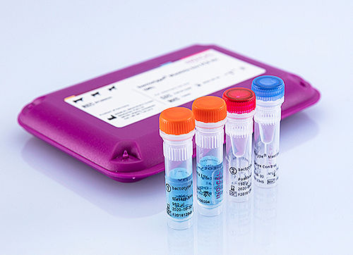 Mastitis test kit - bactotype - INDICAL BIOSCIENCE - for infectious ...