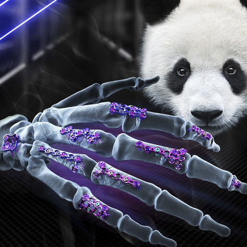 Hand phalange compression plate - PANDA - AGOMED Medizin-Technik ...