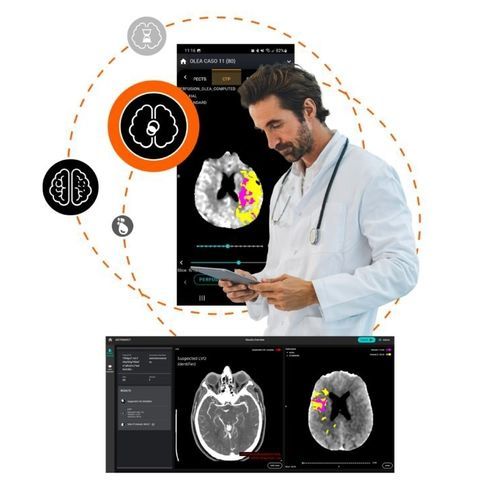 Image analysis software - Olea Medical - medical / CT / lung