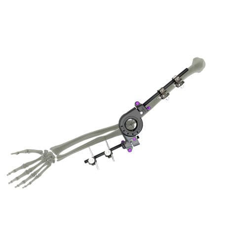 Elbow external fixation system - UniX® - WishBone Medical - tubular / adult