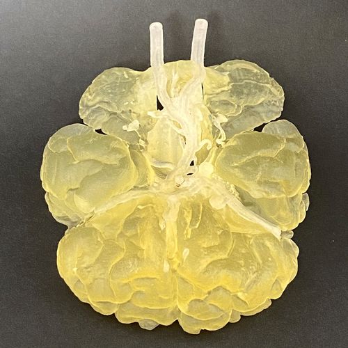 Artery model - Circulus Willisii - Schiner3DRepro - circulus arteriosus ...