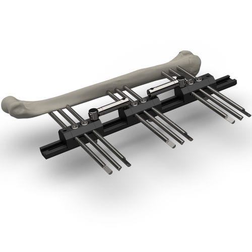 Humerus external fixation system - TF-ERS - TASARIMMED - tubular ...