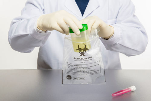 Biological samples packaging pouch - BIOHAZARD - ORUM INTERNATIONAL ...