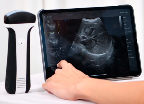 Hand-held ultrasound system - LU700C - Leltek Inc - for multipurpose ...