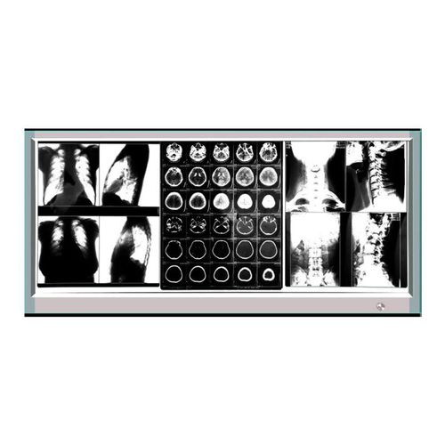 3-screen X-ray film viewer - GP1003A - Bellamoon Medical - LED