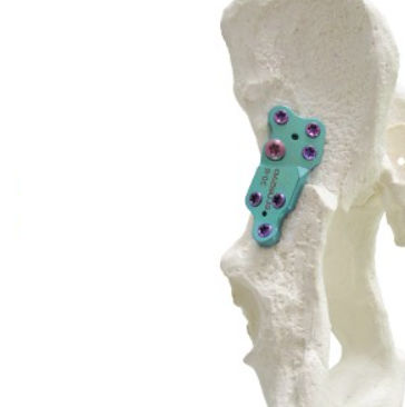 Hip veterinary bone compression plate - DPO - Anhui Bailu Small Animal ...