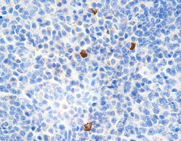 Immunoglobulin G4 reagent - CIR-0131 - Celnovte Biotechnology Co., Ltd ...