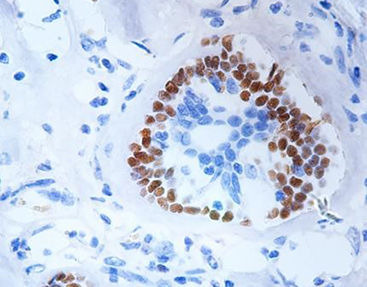 Staining solution reagent - CPM-0160 - Celnovte Biotechnology Co., Ltd ...