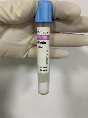 Platelet rich plasma collection tube - Cangzhou Yongkang Medical ...