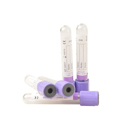 EDTA collection tube - Cangzhou Yongkang Medical Devices Co., Ltd ...