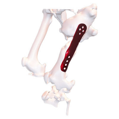 Generic veterinary bone compression plate - Osteophoenix