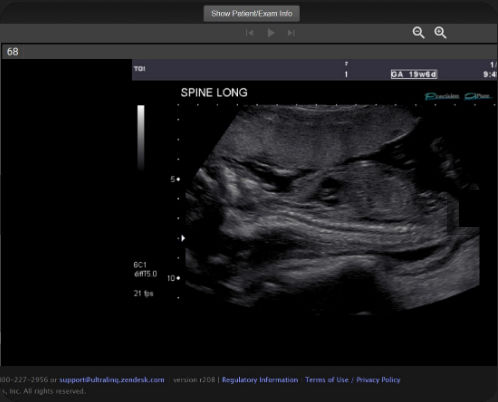 Medical imaging PACS - UltraLinq
