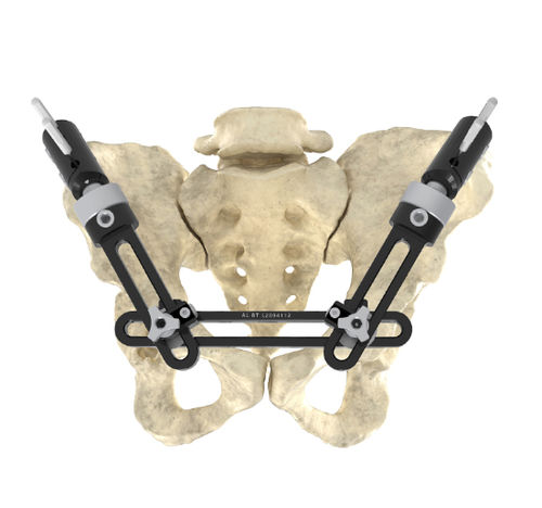 Pelvis external fixation system - Wuxi Betta Medical Technology ...