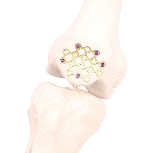 Patella compression plate - WX 2.7 - Kangli Medical - locking / titanium