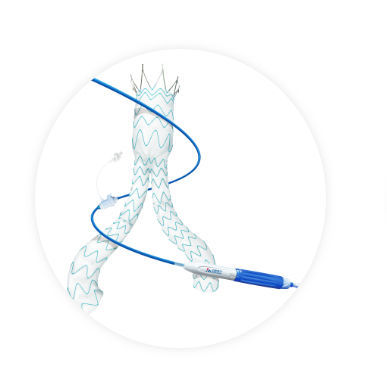 Abdominal aorta stent graft - Minos™ - Endovastec - iliac artery ...