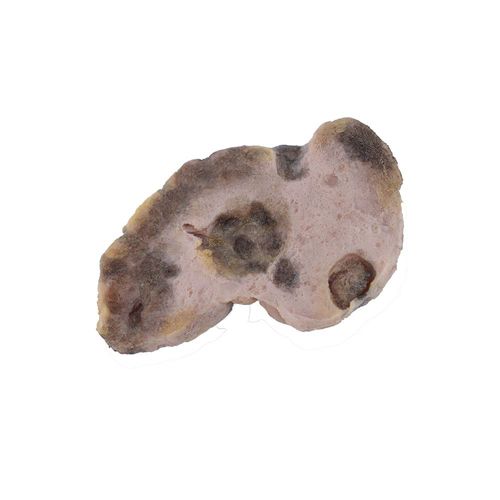 Ovary model - PS-003 - MeiWo Science - for teaching / for cancers ...