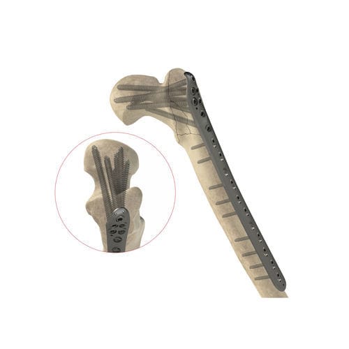 Femoral compression plate - Ases Orthopedics - proximal / locking