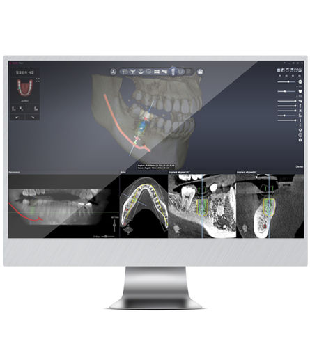 Dental surgery surgical navigation system - Neobiotech - optical