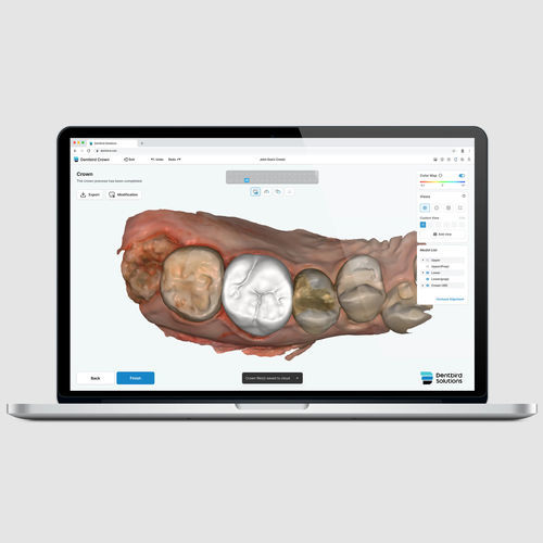 Design software - Dentbird Crown - Imagoworks Inc. - CAD / scan / printing