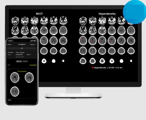 Diagnostic software - ICH - RapidAI - medical / clinical / CT