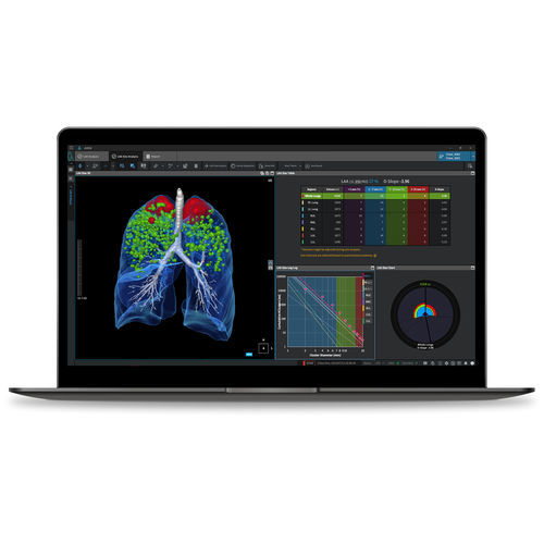 Analysis software - COPD - Coreline - visualization / treatment ...