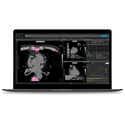 Analysis software - CAC - Coreline - reporting / medical / CT