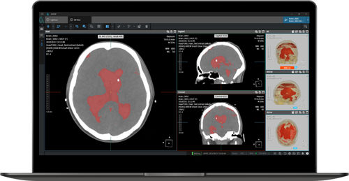 Analysis software - NeuroCAD - Coreline - viewer / diagnostic / treatment