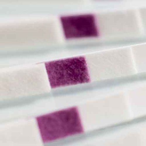 Kidney disease test strip - GBR-3409 - Golden BioTechnologies - AMP ...