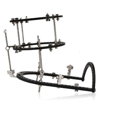 Ankle external fixation system - 17.232.04 series - 7S Medical ...