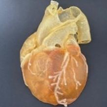 Heart model - AM10HM - Samed - training / catheterization