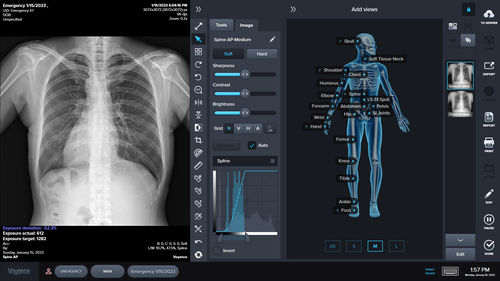 Control software - voyance - acquisition / for x-ray imaging / automated